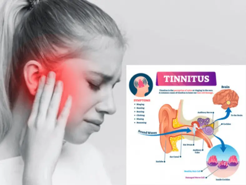 Tinnitus 911 Review - Tinnitus 911 Scam Or Legit? [Unbiased & In-Depth Review]