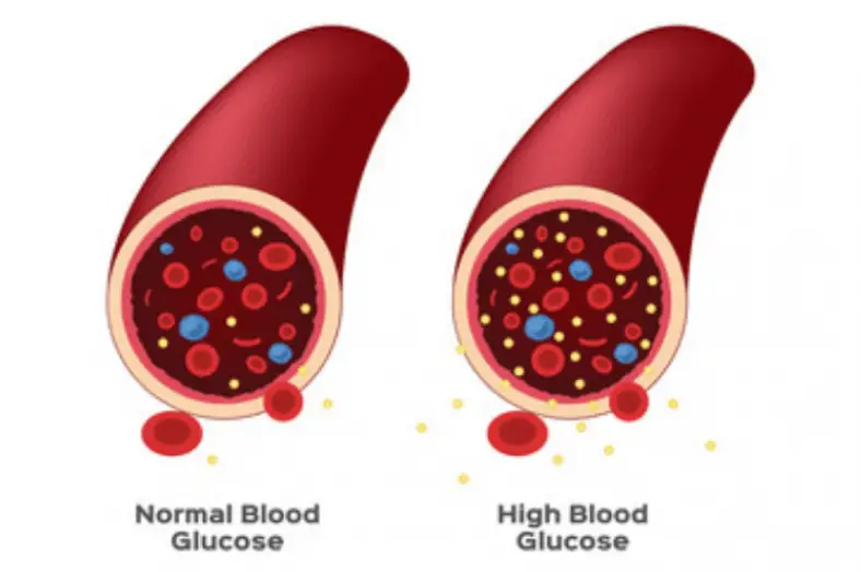 Normal Blood Sugar of Non-diabetic Child