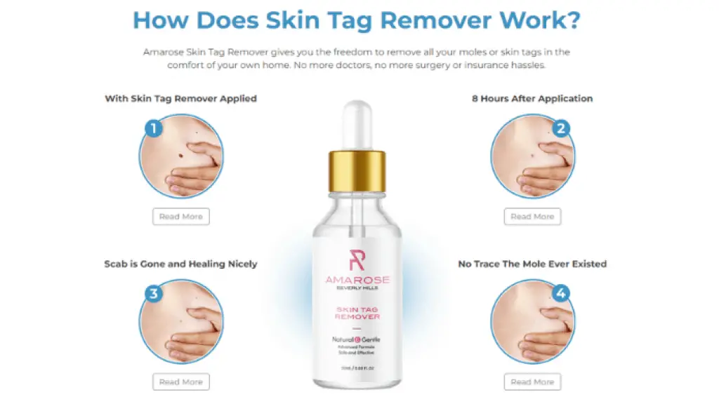 Amarose Skin Tag Remover Review - How Does It Work? [Must Read]